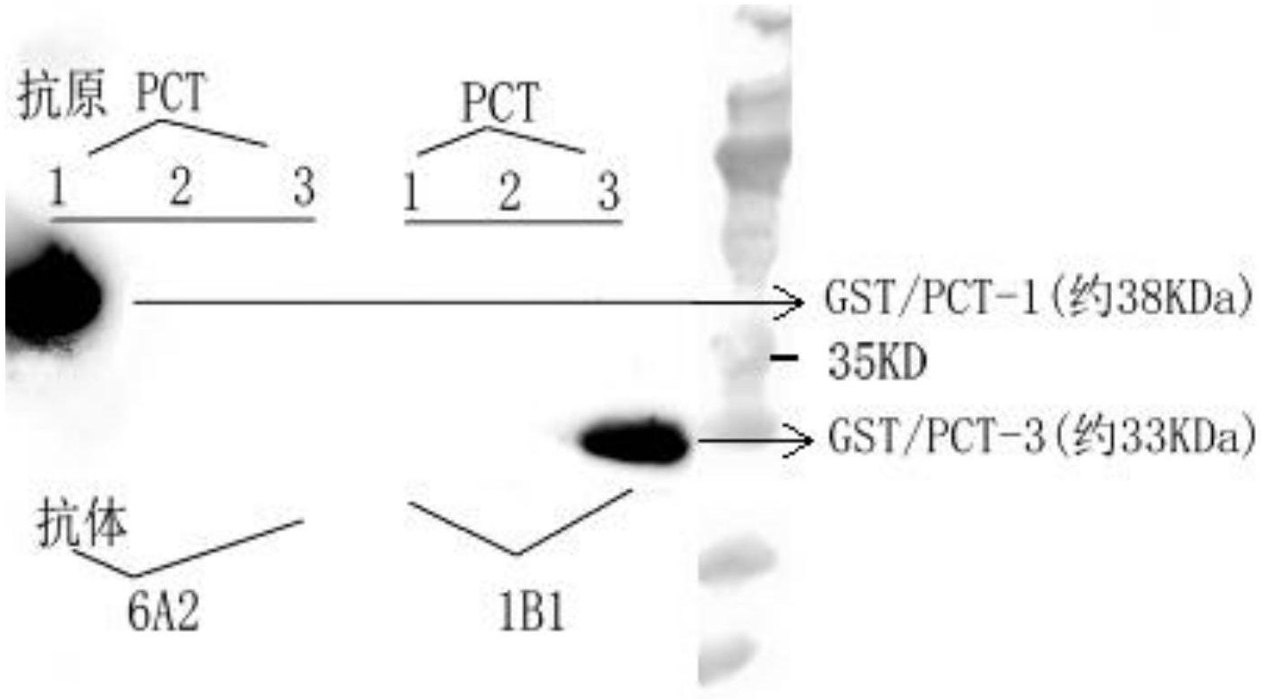 杂交瘤细胞株A4-1B1及其产生的降钙素原单克隆抗体和应用 - 爱企查