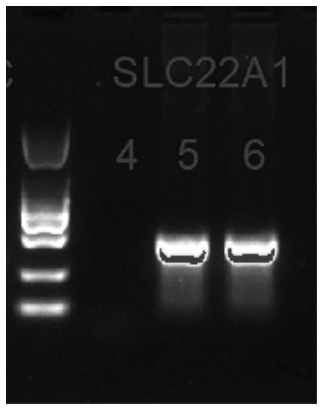 基于Sanger测序法检测SLC22A1基因突变的引物、试剂盒及方法 - 爱企查